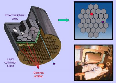 Gamma-camera : principles - radioactivity.eu.com