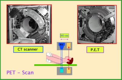 PET Scan - radioactivity.eu.com